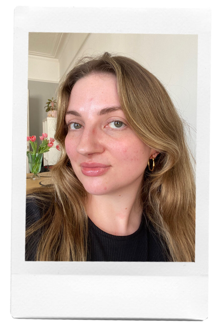 We Tried Skin + Me: The Dermatologist-Designed Skincare Delivered ...